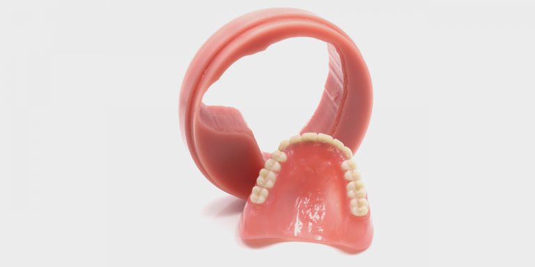 Totalprothese – Dentallabor Feldmann